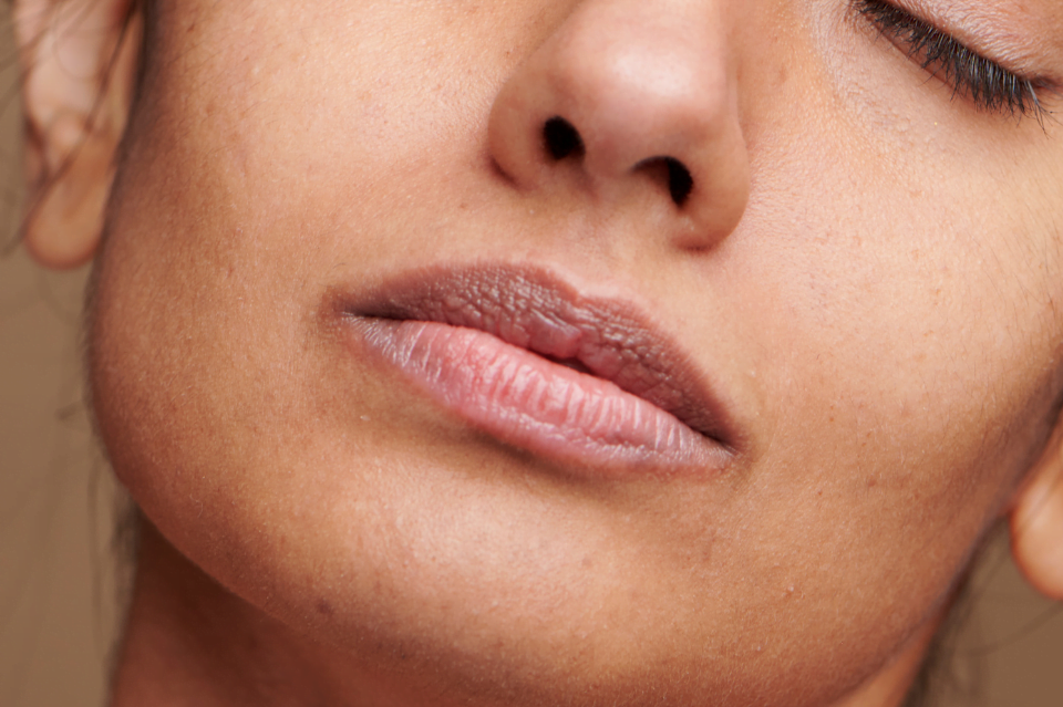 Labbra screpolate: rimedi e cause » Moody Skin - Skincare Coreana